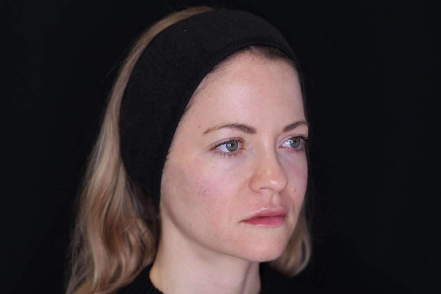Prevention Over the Cure: A 3D Face Refresh at Viva Skin Clinics ...