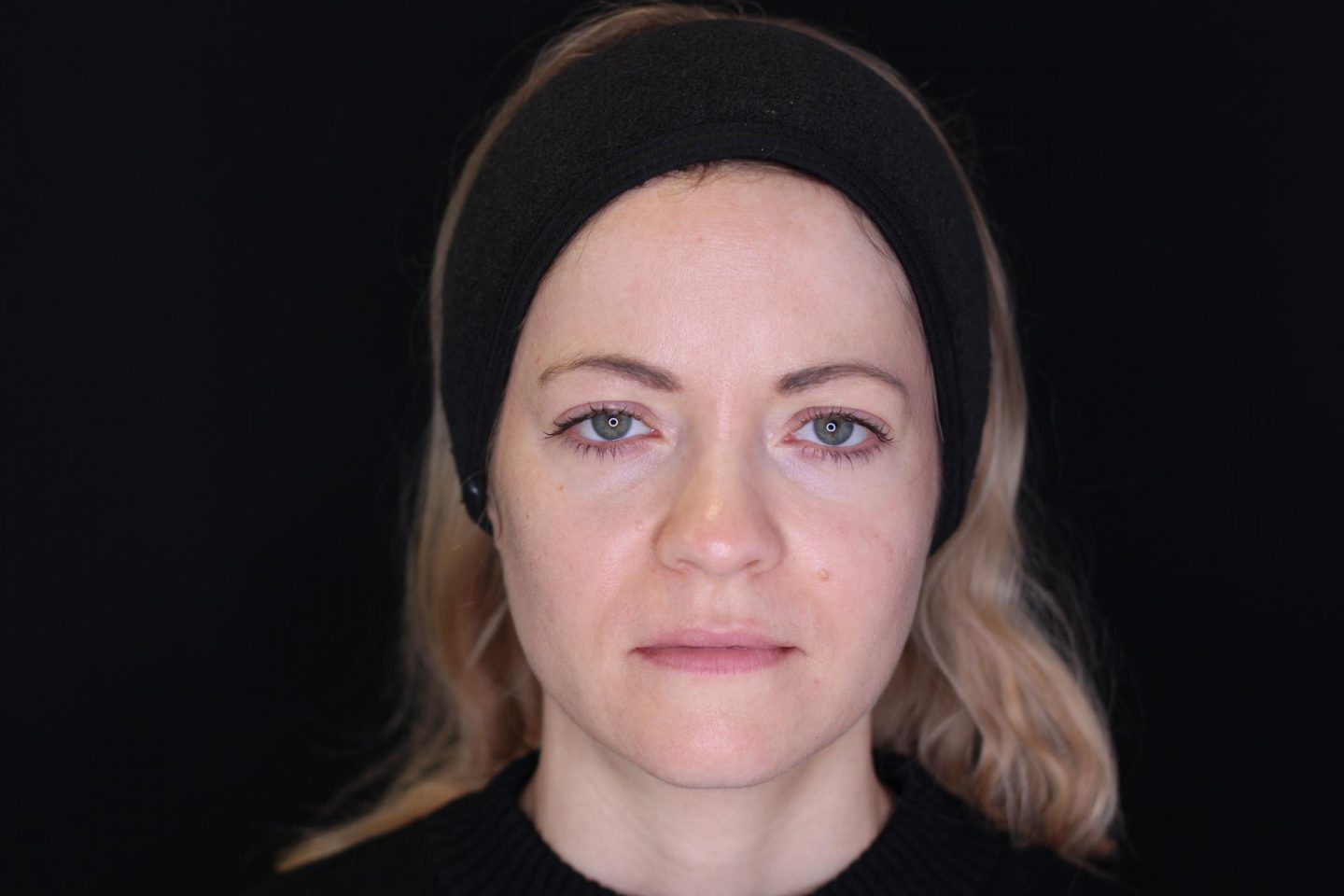 Prevention Over the Cure: A 3D Face Refresh at Viva Skin Clinics ...