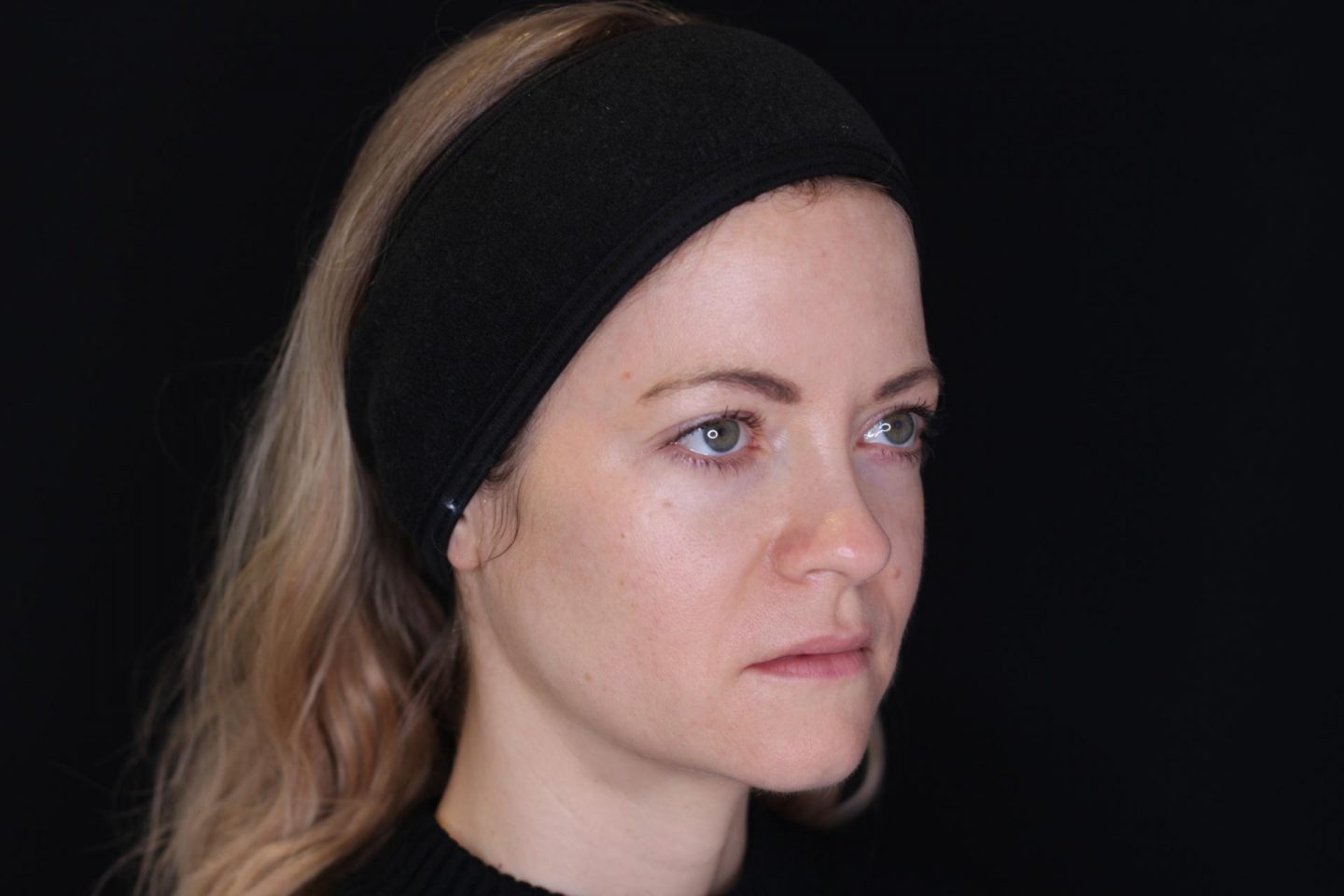 Prevention Over the Cure: A 3D Face Refresh at Viva Skin Clinics ...